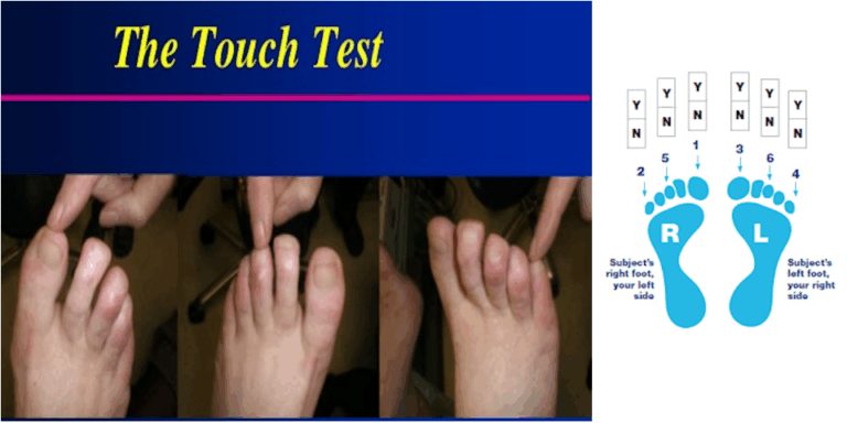 Hướng dẫn Khám Cảm Giác Bằng Chạm Nhẹ - Light touch