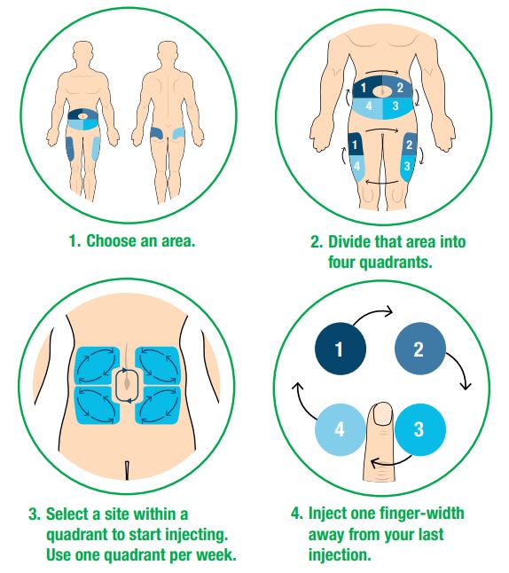 Vị trí tiêm insulin tốt nhất cho hiệu quả tối ưu
